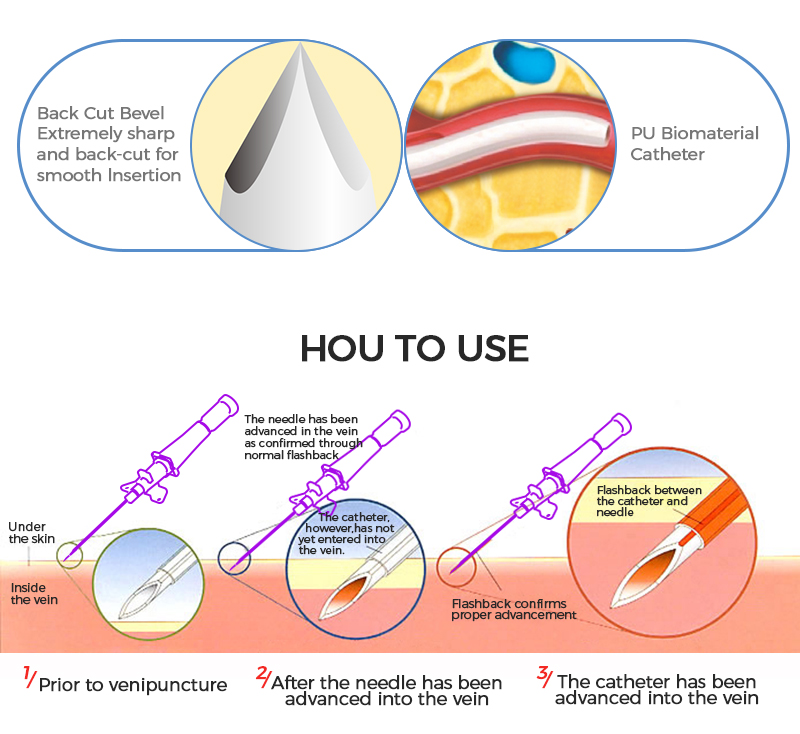 China VETERINARY I.V. CATHETER WITH WINGS FOR PETS Manufacturer and ...