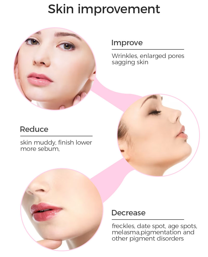 China Disposable Cosmetic Filler Injection Needles 4 Pin Manufacturer ...